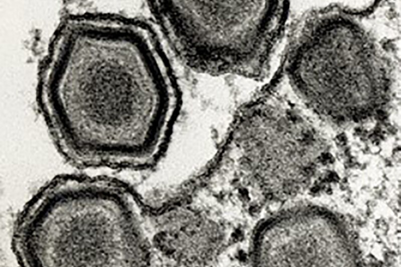 How Does Storage and the Freeze-Thaw Cycle Affect African Swine Fever ...