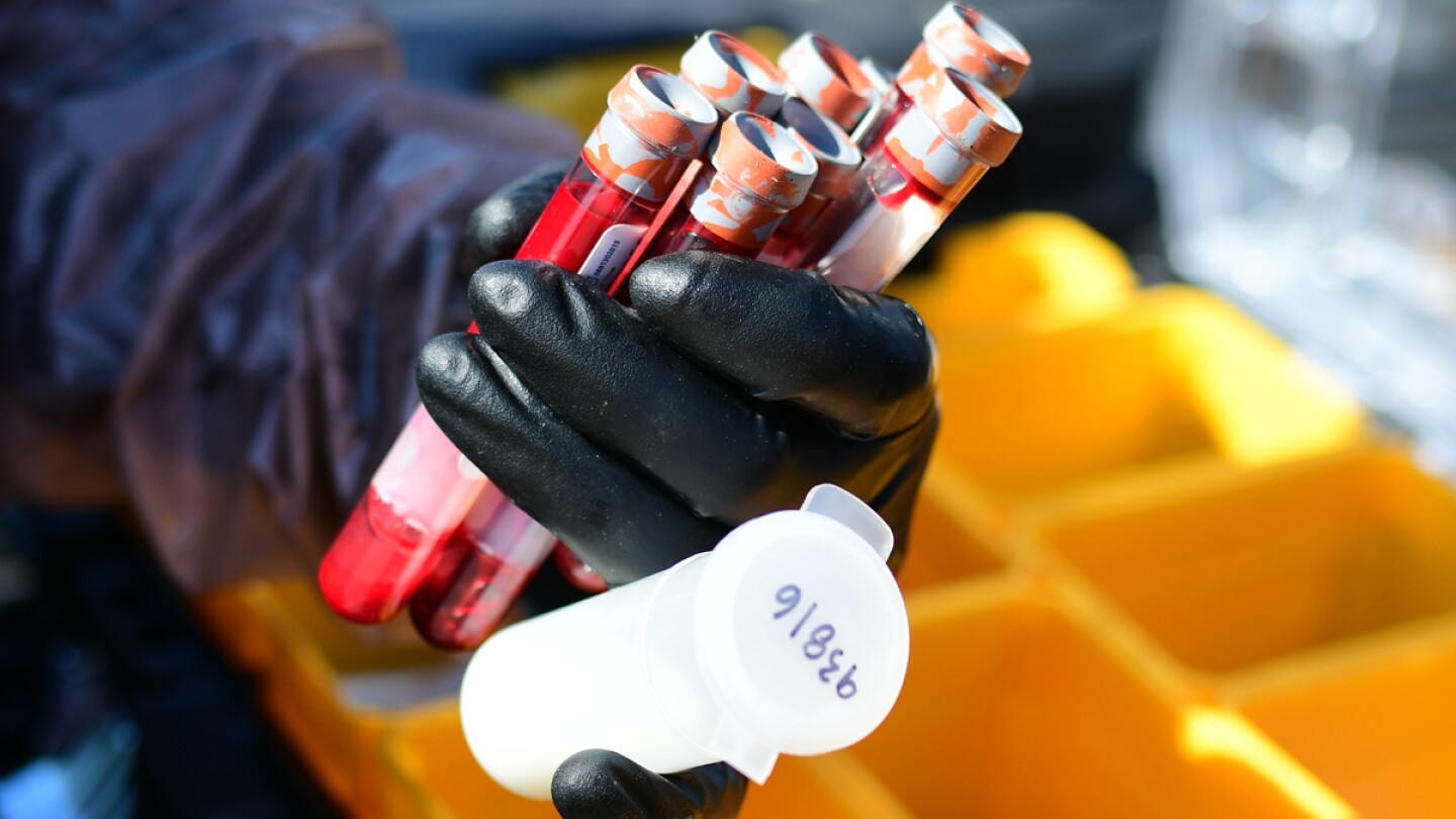 Wisconsin Will Now Require a Negative HPAI Test in Order to Exhibit ...