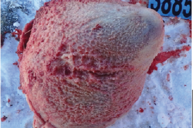 fibrinous pericarditis