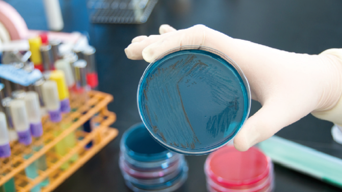 FDA proposes redesign of Human Foods Program to enhance coordinated ...